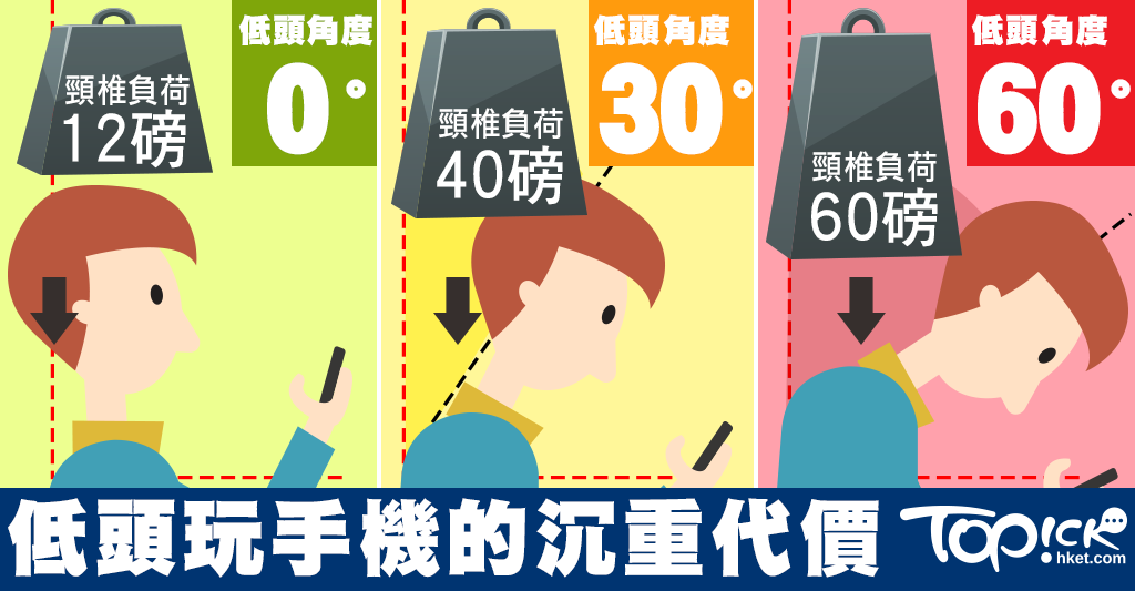 低頭60°頸椎負荷60磅 14歲少年頸椎生骨刺