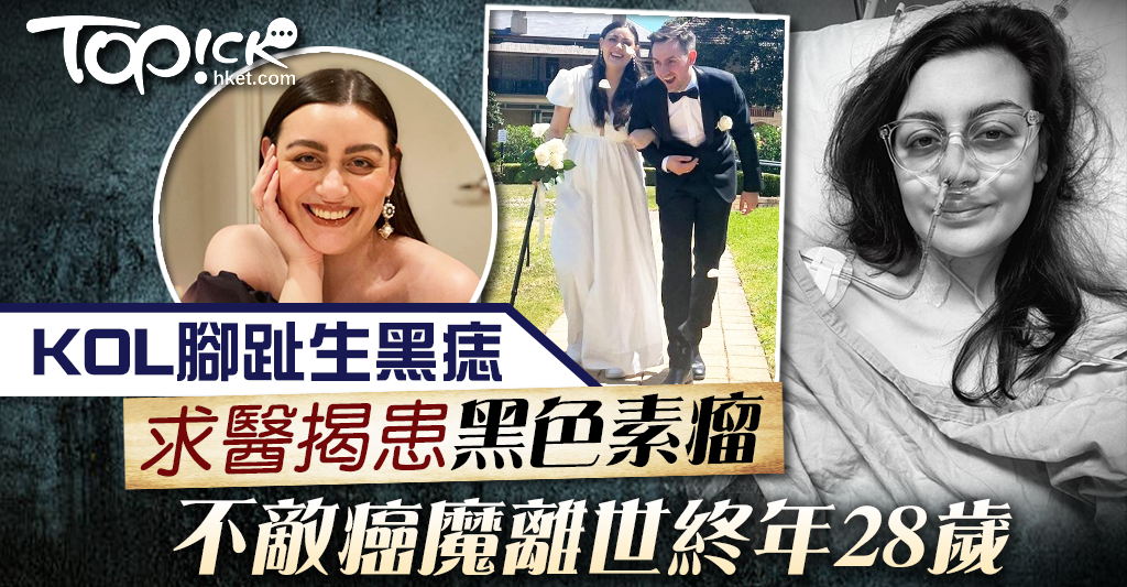 【癌症殺手】脚趾生黑痣揭患黑色素瘤 28歲KOL不敵癌魔離世