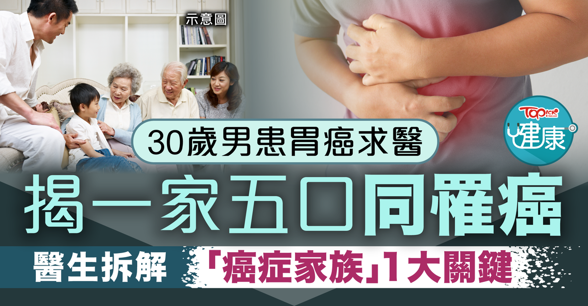 癌症遺傳？｜30歲男患胃癌求醫揭一家五口同罹癌 醫生拆解「癌症家族」1大關鍵