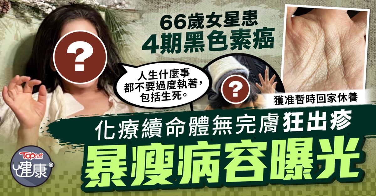 抗癌勇士｜66歲女星患4期黑色素癌暴瘦病容曝光 化療後皮膚裂開體無完膚狂出疹