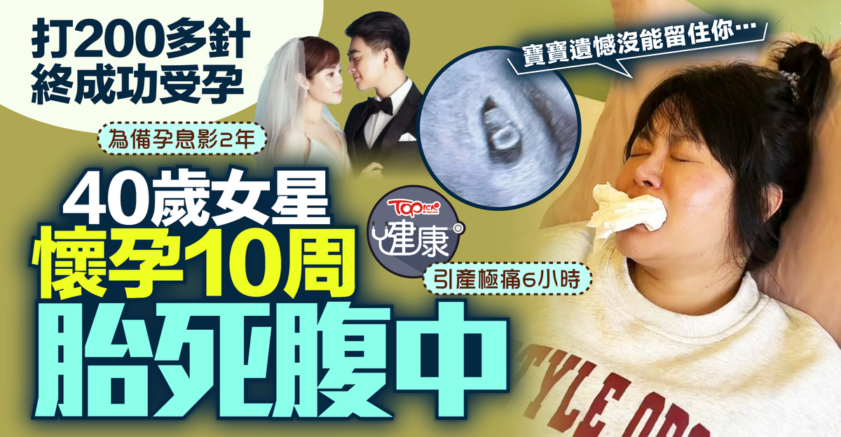 高齡懷孕丨打200多針終成功受孕 40歲女星懷孕10周胎死腹中