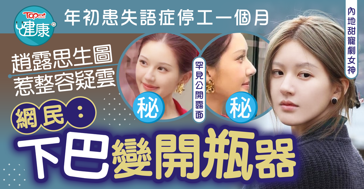明星保養｜年初患失語症停工一個月 趙露思生圖惹整容疑雲