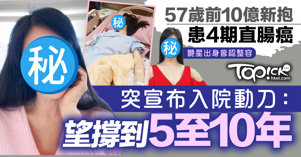 直腸癌｜57歲前10億新抱患4期直腸癌 突宣布入院動刀：望撐到5至10年
