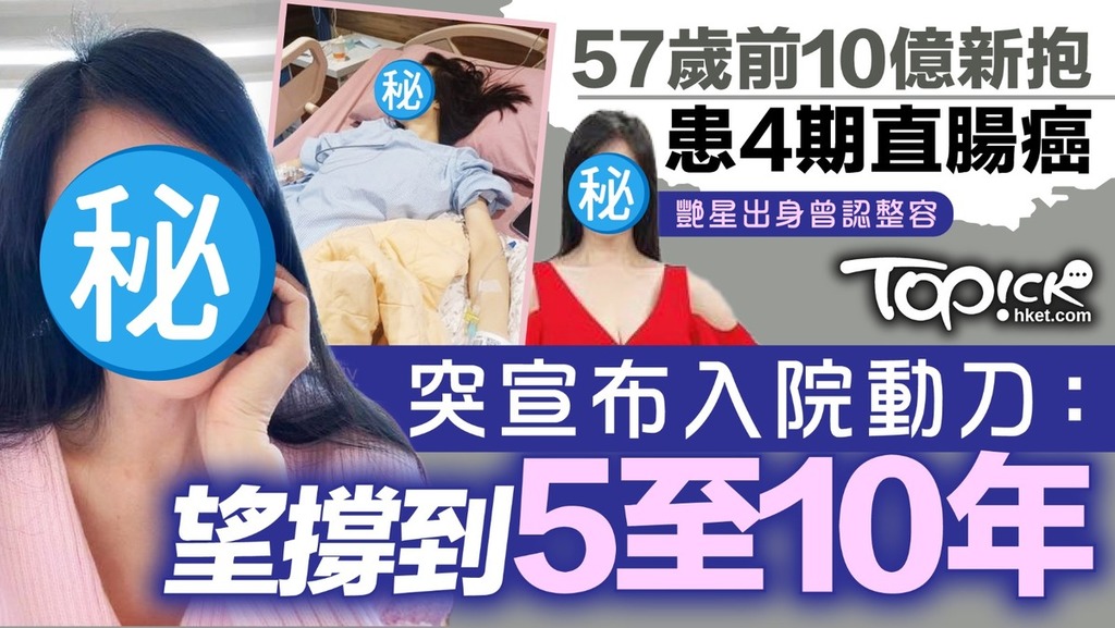 直腸癌｜57歲前10億新抱患4期直腸癌 突宣布入院動刀：望撐到5至10年