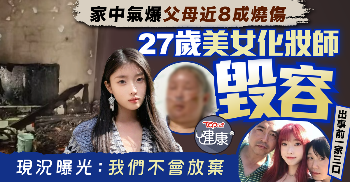 家居意外丨家中氣爆父母近8成燒傷27歲美女化妝師毀容 現況曝光：我們不會放棄