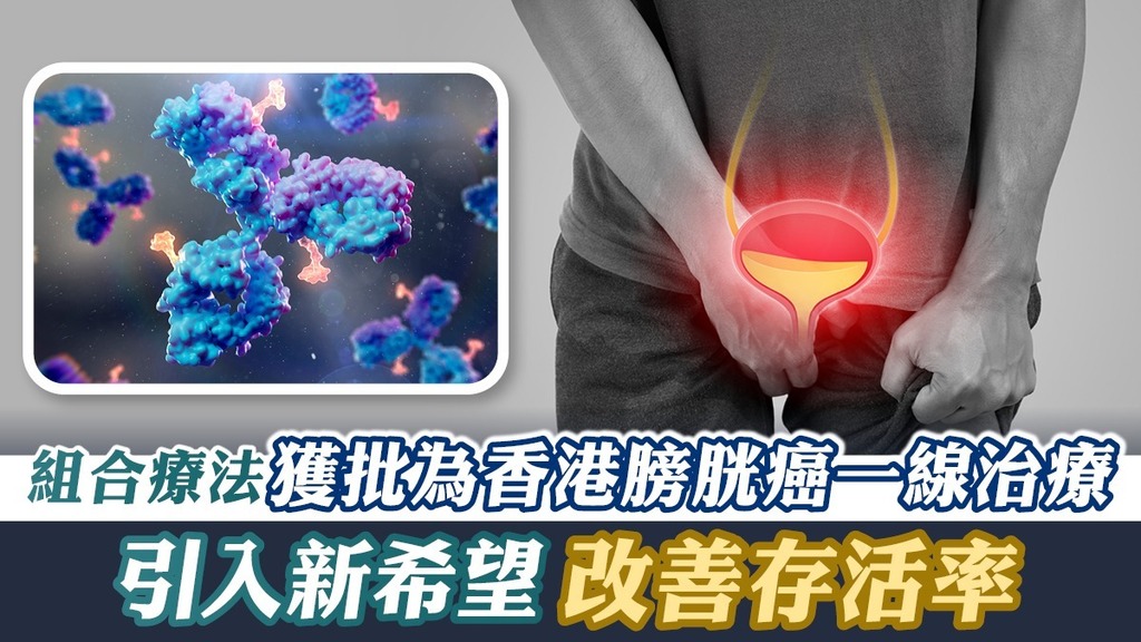組合療法獲批為香港膀胱癌一線治療 引入新希望改善存活率